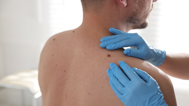 Cutting-Edge Non-Invasive Skin Imaging Achieves Near-Histologic ...